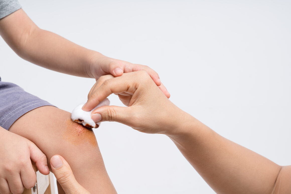 Surf Trip First Aid Kit: What to Pack and Why - Yeeew! Mag